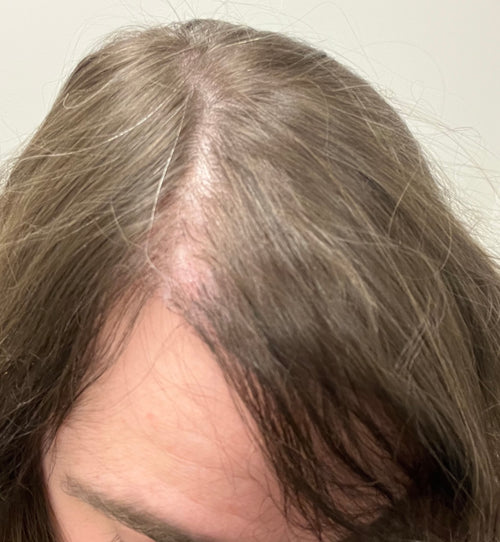 2ddr | Best Product For Hair Loss | 2 Deoxy D Ribose 2ddr Gel