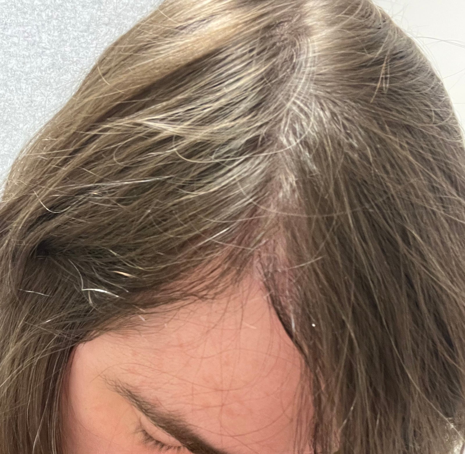 2ddr | Best Product For Hair Loss | 2 Deoxy D Ribose 2ddr Gel