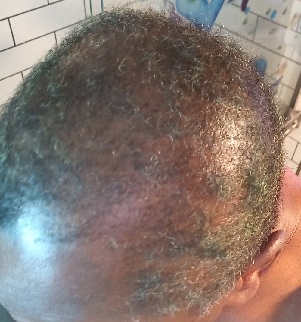 2ddr | Best Product For Hair Loss | 2 Deoxy D Ribose 2ddr Gel