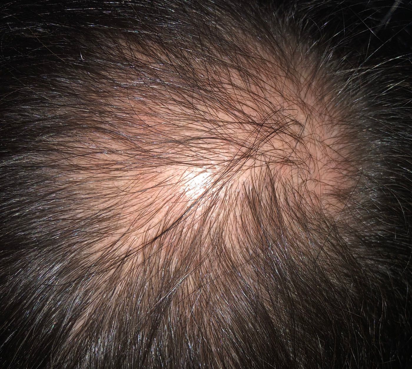 2ddr | Best Product For Hair Loss | 2 Deoxy D Ribose 2ddr Gel